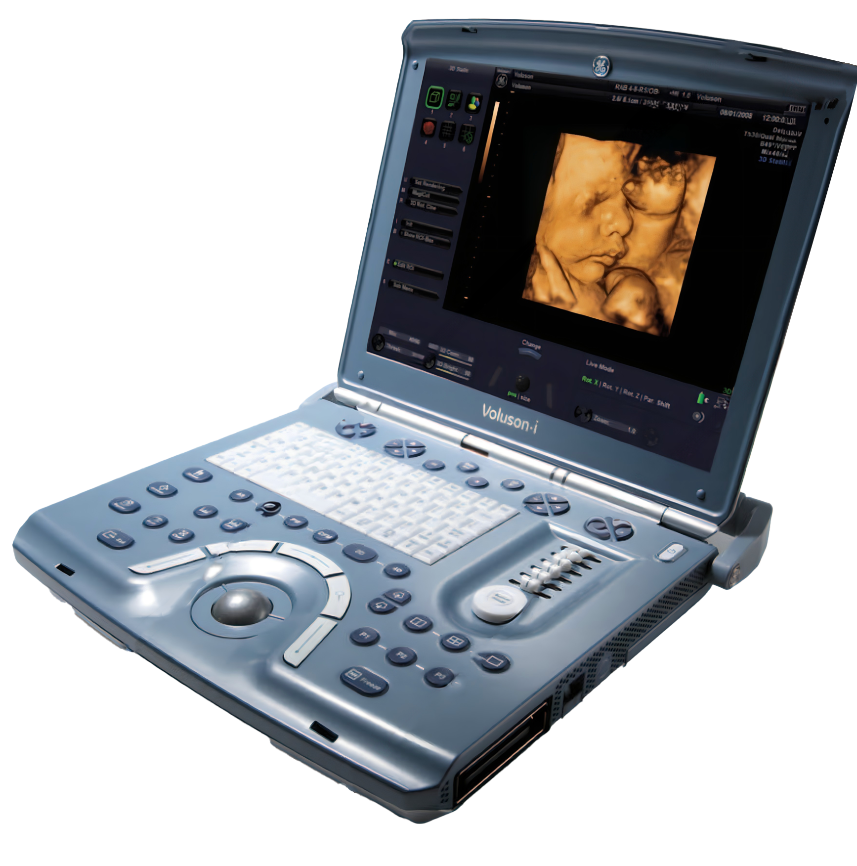 Ge –GE Voluson I Portable Ultrasound Machine – First Medical